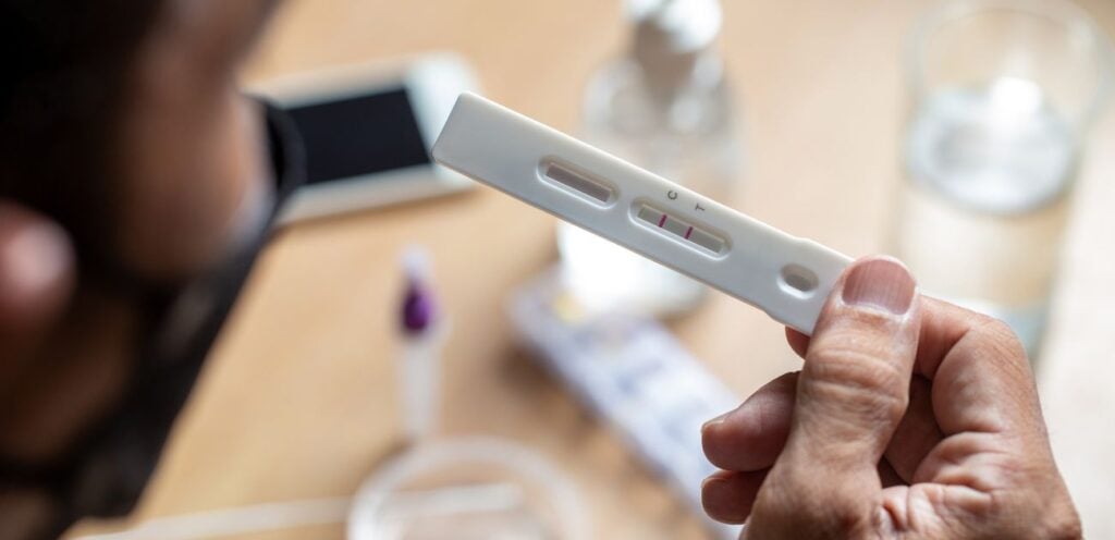 Covid-19 Frankenstein : départements les plus touchés en France